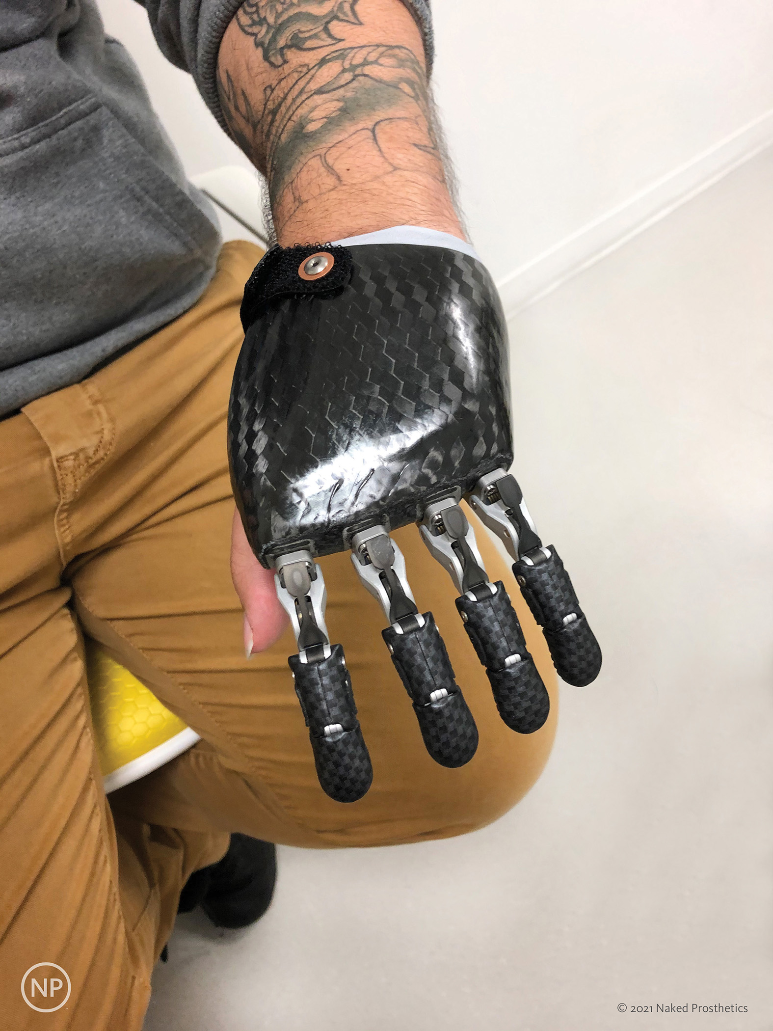 Resources - Naked Prosthetics