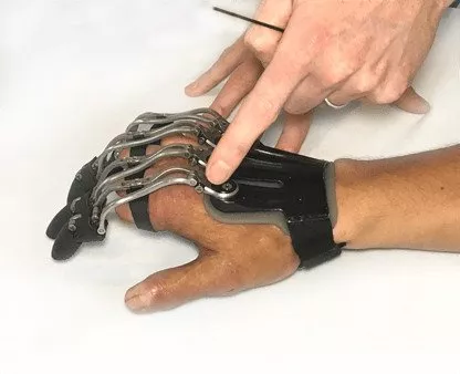 Partnership - Naked Prosthetics