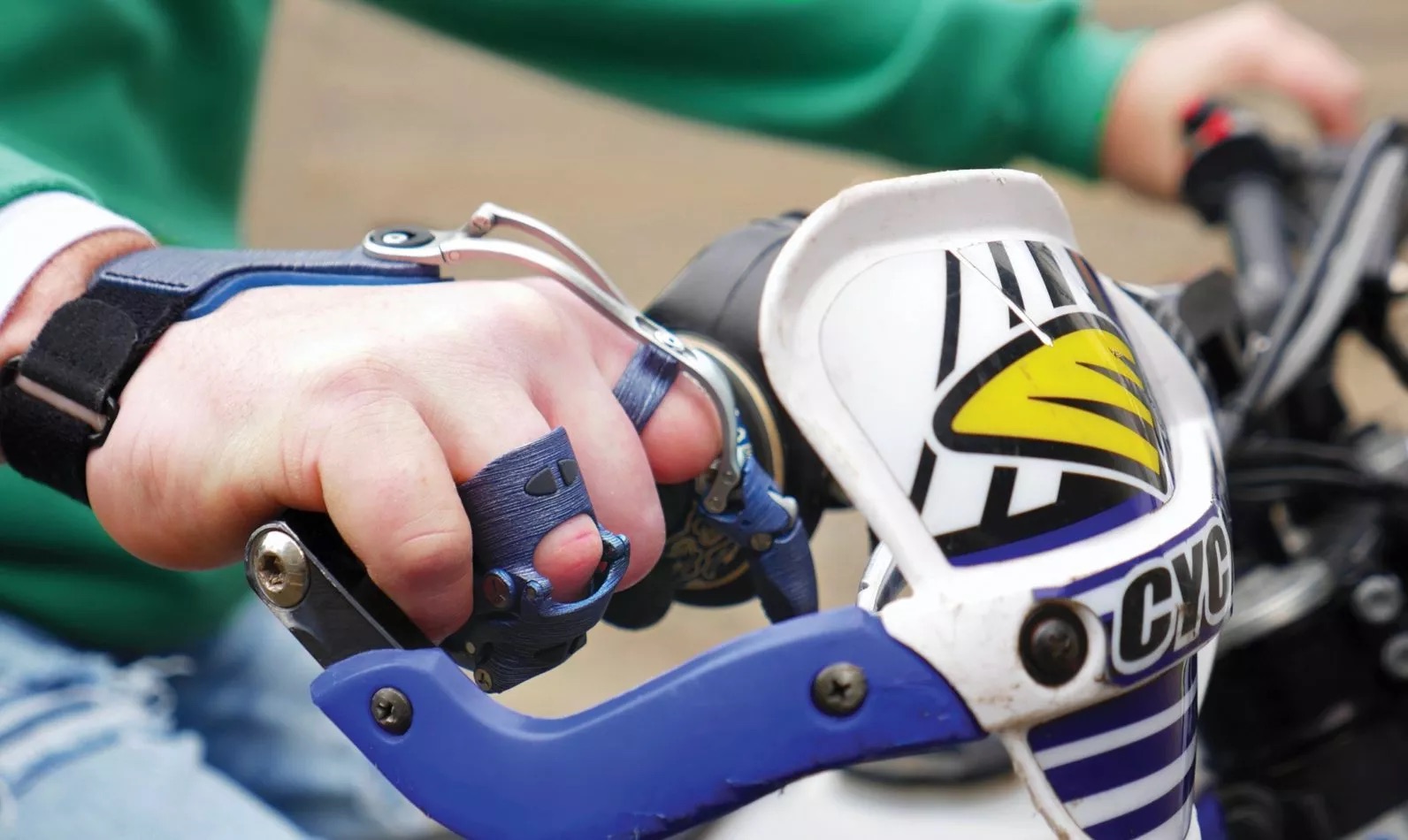 Matt Finney - Naked Prosthetics