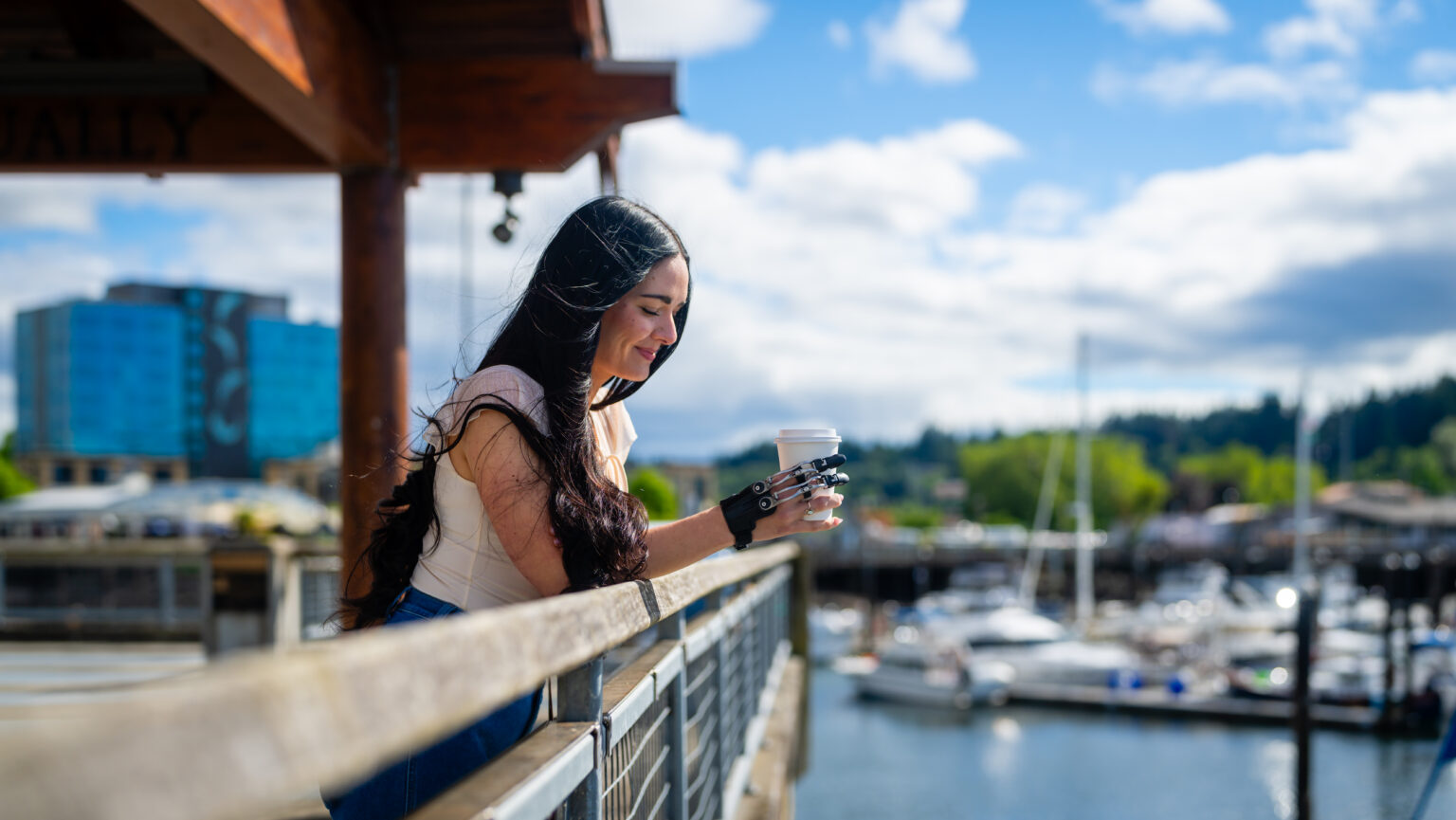 NPChampions - Naked Prosthetics